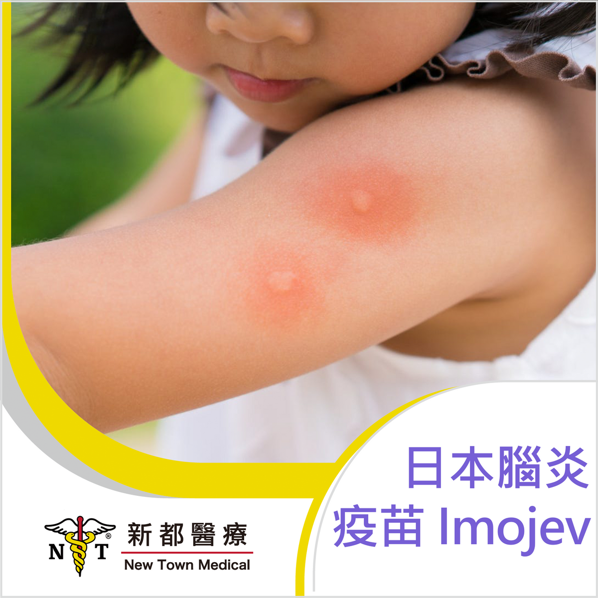 日本腦炎疫苗 - Imojev – 新都醫療 New Town Medical